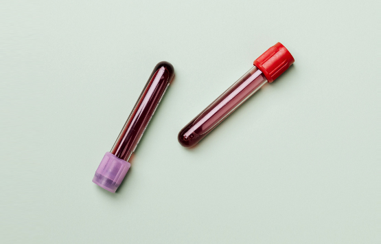 Blood Test Services - Pharma Clinic